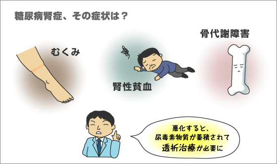 糖尿病腎症を知る!-第2回 腎症になるとどうなる?|糖尿病特集サイト メディマグ